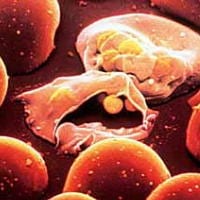 malaria1 | The Skeptics Guide to the Universe